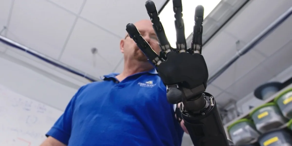 Conocé al hombre que vive con el brazo robótico más avanzado del mundo ...