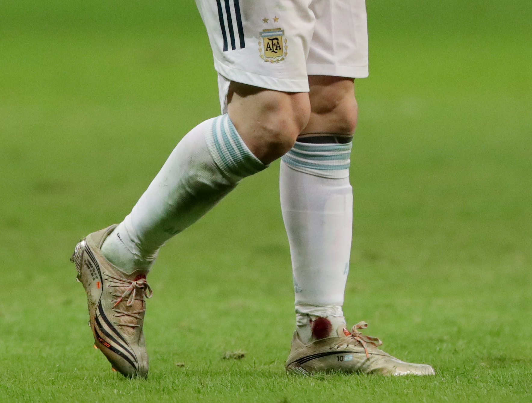 Así le quedó el tobillo a Lionel Messi tras la patada de Frank Fabra ...