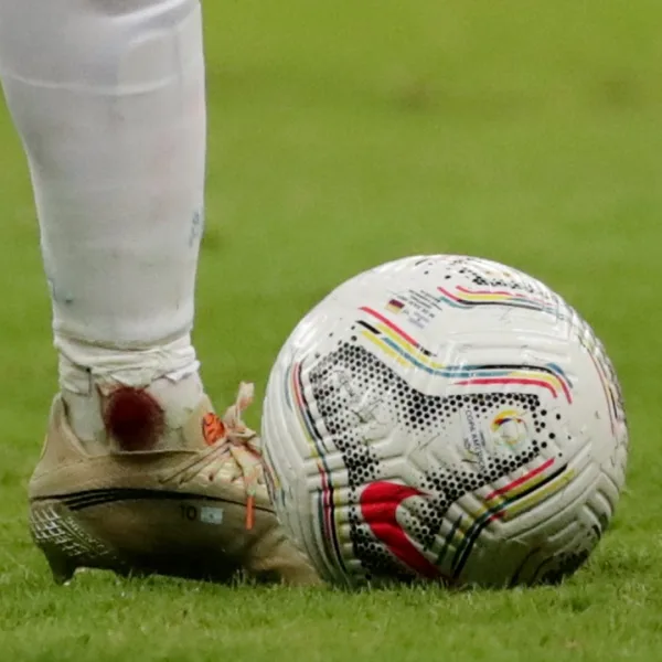 Así le quedó el tobillo a Lionel Messi tras la patada de Frank Fabra ...