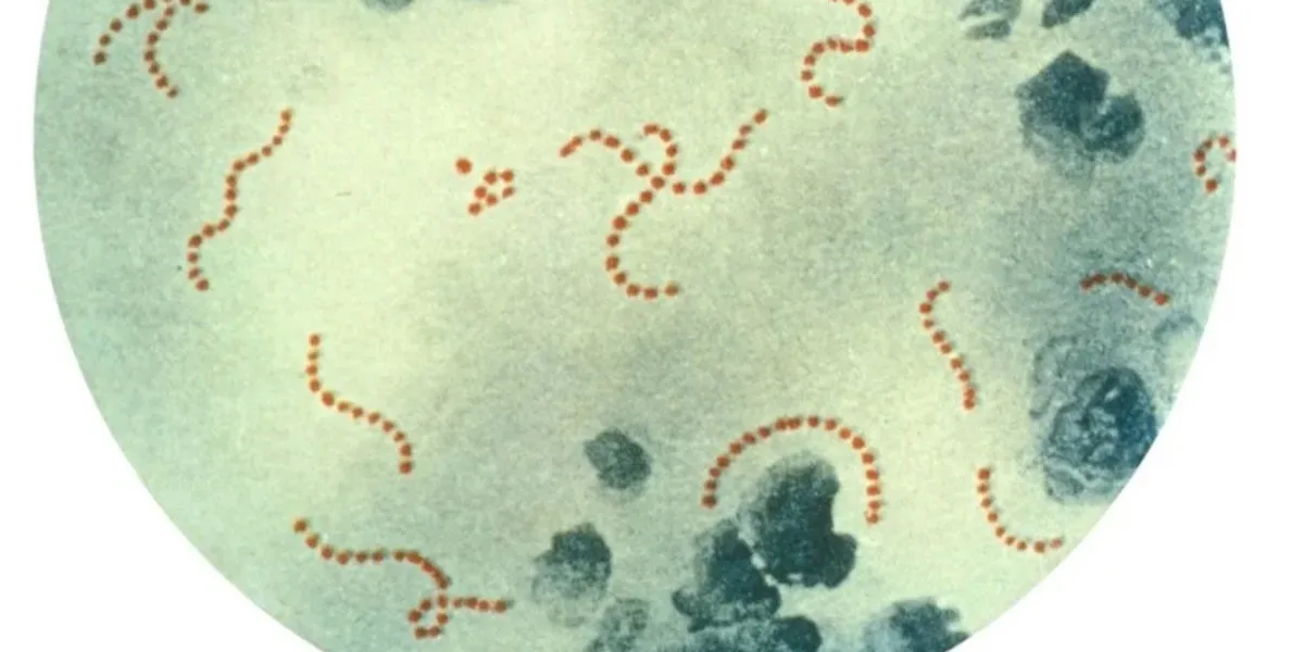 El Ministerio de Salud emitió una alerta por el aumento de casos de ...